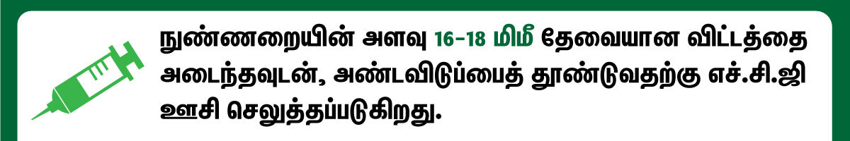 Injection பயன்கள் என்ன? | hCG Injection Uses in Tamil
